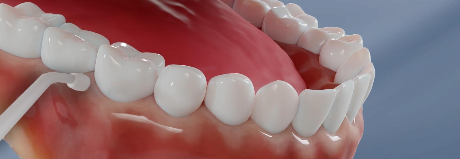 Beyond Brushing: How to Floss with Proper Technique - Audubon Dental